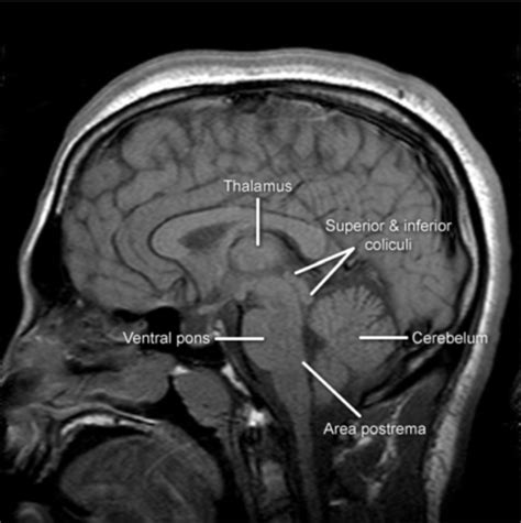 Neuroanatomy Flashcards Quizlet