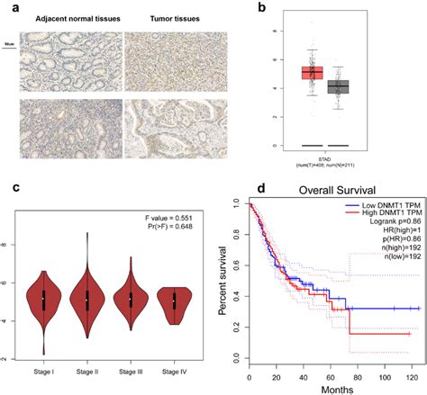 Dnmt1 Was Up Regulated In Gc Tumour Tissues Compared With Adjacent Download Scientific Diagram