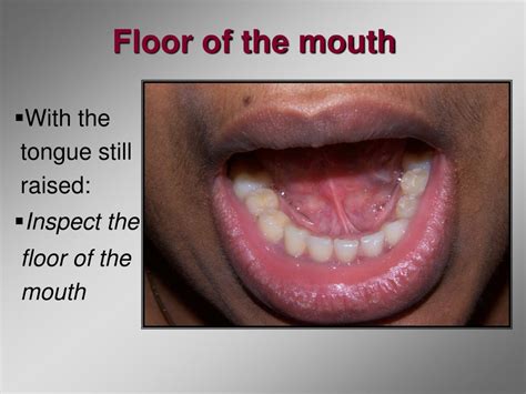 What Is The Floor Of The Mouth Called Wilson Darren