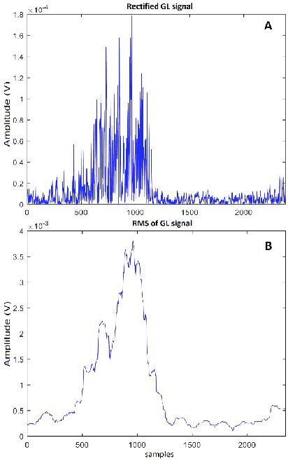 Rectified Surface Electromyography Semg Panel A And Root Mean Download Scientific Diagram