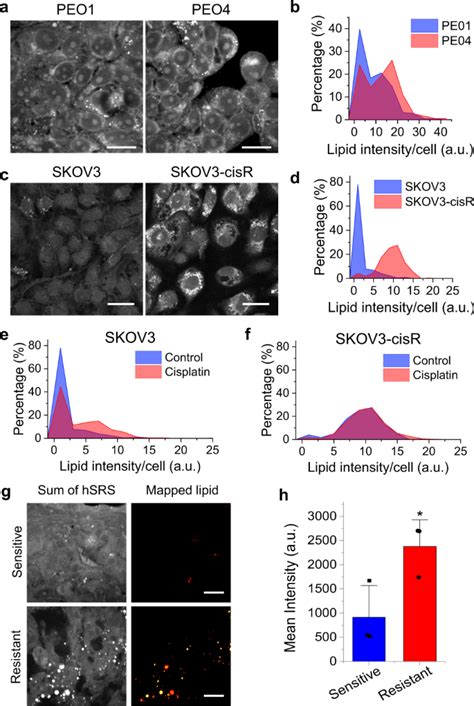 铂耐药癌细胞中从糖酵解到脂肪酸摄取和β 氧化的代谢重编程 Nature Communications X Mol