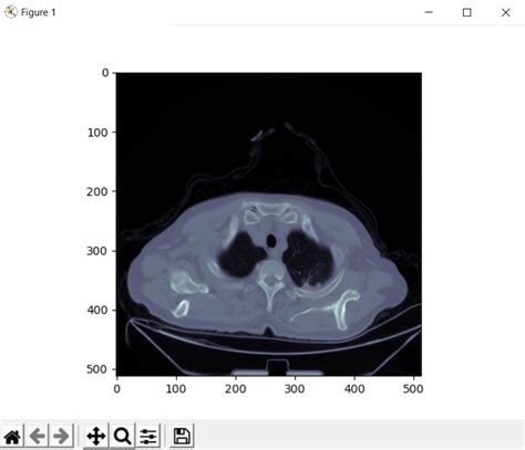 View Dicom Images Using Pydicom And Matplotlib Geeksforgeeks