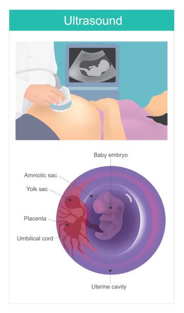 Human Amniotic Sac