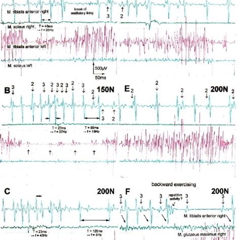 The Cognitive Panic Cycle Formulation Developed With Paul Based On The