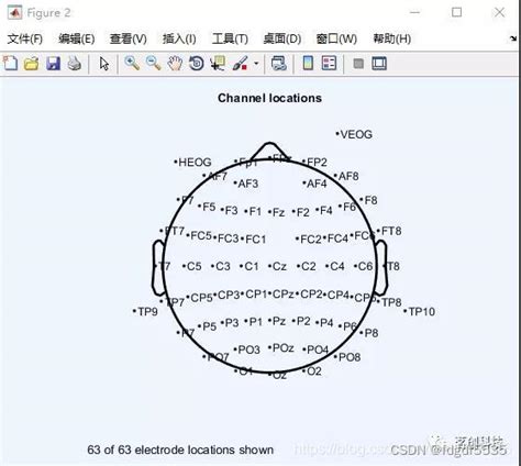手动使用eeglab进行脑电数据预处理ui过程 函数调用代码 批处理 脑电数据预处理history csdn博客