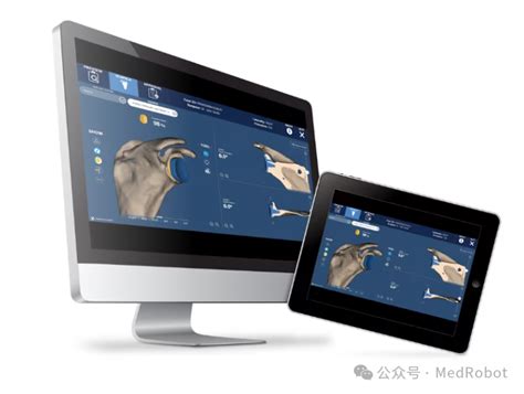 获批fda！全球首款肩关节置换手术机器人 艾邦高分子 艾邦智造官网