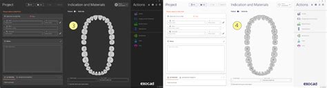 User Interface Exocad