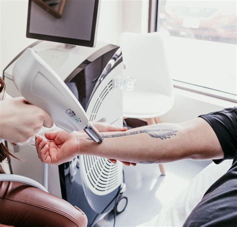 Laser Tattoo Removal — Texas Laser And Aesthetics Med Spa