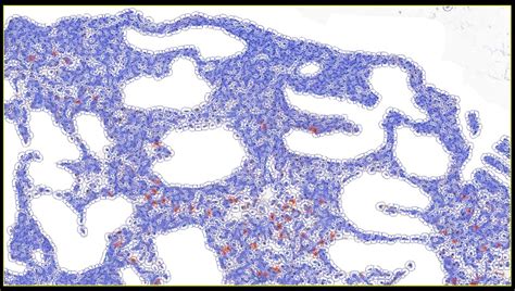 Positive Dab Cell Selection On Multiple Images In Qupath Image Analysis Image Sc Forum