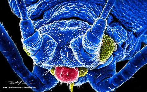 Scanning Electron Microscpy Photography By Robert Berdan The Canadian Nature Photographer