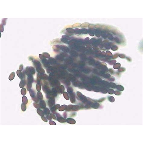Yeast Slide Microscope Yeast Cells Microscope Slide Pin For Sale By