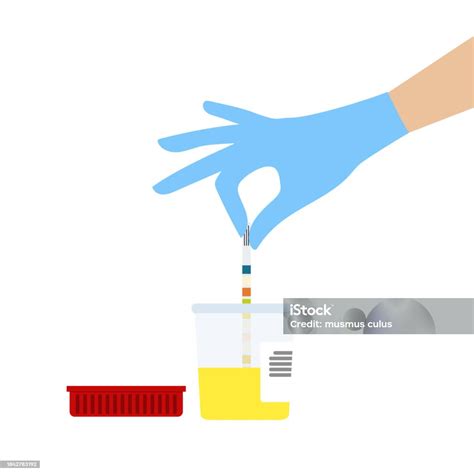 소변 샘플 소변 검사 소변 내 요소의 양을 측정하는 인간의 손 소변 샘플에 대한 스톡 벡터 아트 및 기타 이미지 소변 샘플 소변 화학 과학 Istock