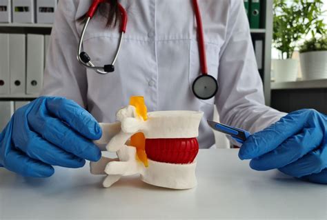 Whos A Good Candidate For Disc Replacement Surgery