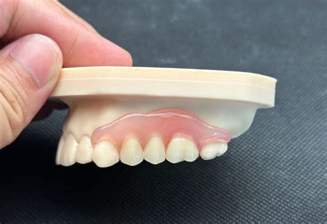 Flexible Denture Mtz Dental Lab