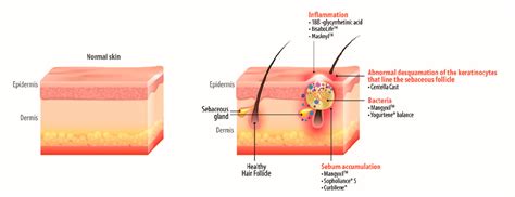 Figure 1 From Synergistic Use Of Bioactive Agents For The Management Of