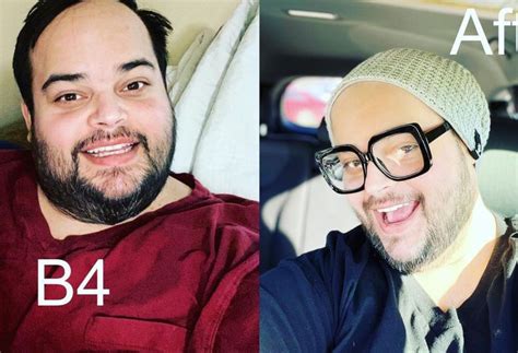 Vite Al Limite Wess Schulze Oggi In Fin Di Vita Per Il Dottor Nowzaradan Contrataque