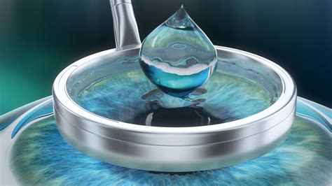 Our Guide To Prk Laser Vision Correction Zeiss