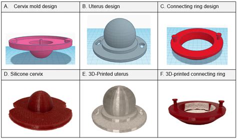 Assessment Of A Novel 3d Printed Gynecological Task Trainer To Advance Medical Education Through