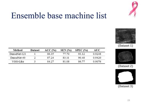 Computer‐aided Diagnosis Of Breast Cancer Using Ensemble Convolutional Neural Networks