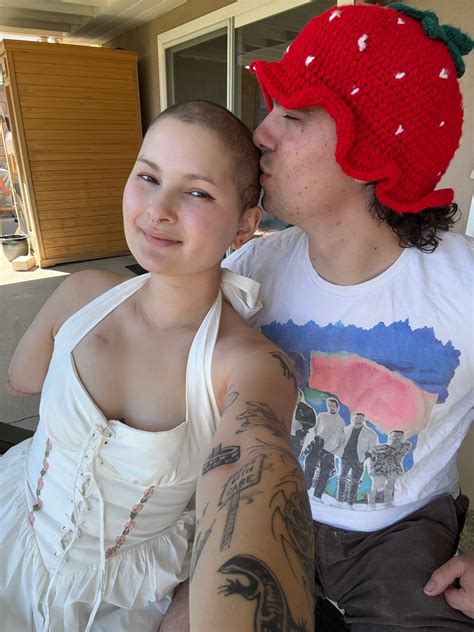 Sarcoma Survivor Held A Funeral For Her Arm Following Amputation