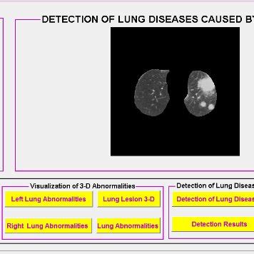 Results Of Lung Segmentation Download Scientific Diagram