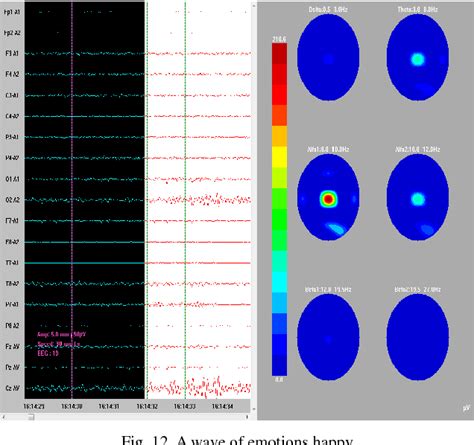 Figure From Human Emotion Detection Via Brain Waves Study By Using Electroencephalogram EEG