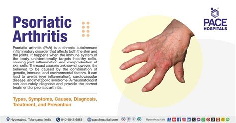 Choledocholithiasis Cbd Stone Symptoms Causes Complications