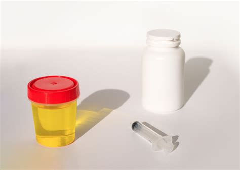 Workplace Drug Testing In Victoria Ohs Reps