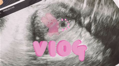 시험관 임신 브이로그 첫 초음파 작은 아기집주수 차이 Youtube