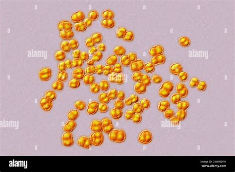 Meningococcus Or Meningococcal Disease Or Neisseria Meningitidis Is A Bacteria Involved In
