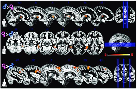 Group Differences For The Body Projection Experiment First Row Males