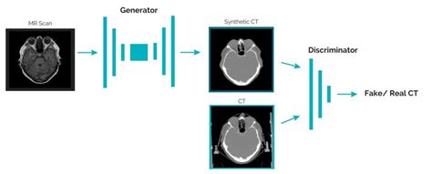Deep Learning To Generate Synthetic Ct Images From Mr For Radiotherapy Treatment Planning