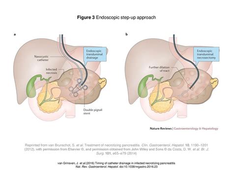 Figure 3 Endoscopic Step Up Approach Ppt Download