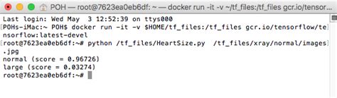 machine learning tensorflow deep learning tutorial “the heart size