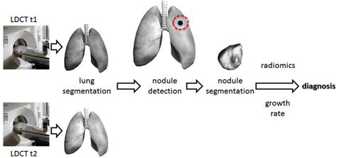 Architecture Of Computer Aided Diagnosis Systems For Lung Cancer Download Scientific Diagram