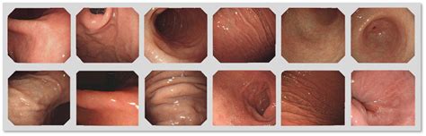 Frontiers Subjective And Objective Quality Assessment Of