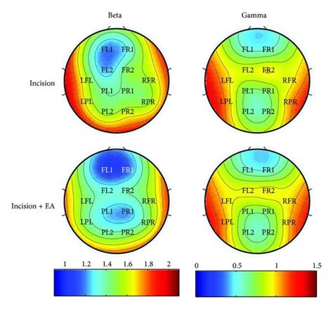 Locations Of Electrodes With Significant EEG Power Change After EA Download Scientific Diagram