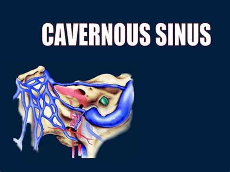 Cavernous Sinus Anatomy And Its Contentspptx