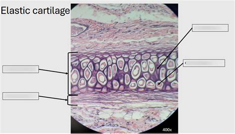 Elastic Cartilage Diagram Quizlet