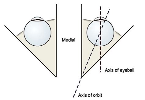 Extraocular Movement Extraocular Muscles