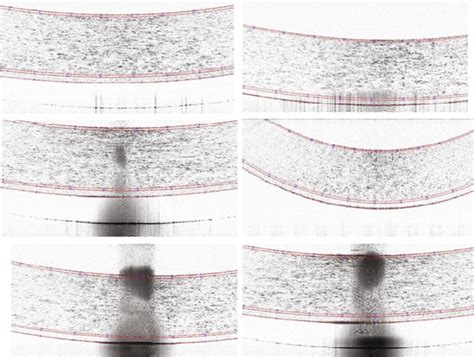 Six Examples Of Applying 2d Corneal Segmentation To Oct Images The Download Scientific Diagram