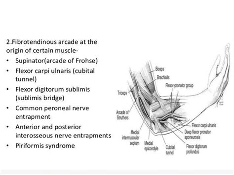 Nerve Compression Syndrome Pptx