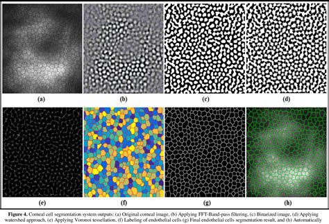Figure 1 From A Fully Automated Cell Segmentation And Morphometric