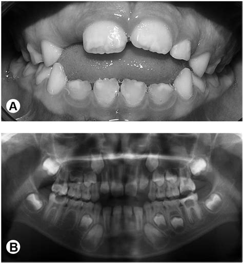 Stellate Iris Williams