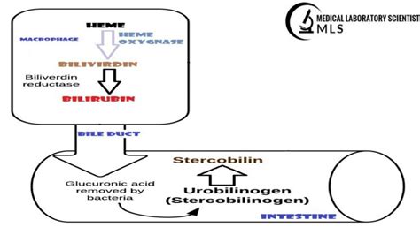 What Is A Jaundice Types Causes Of Jaundice Medical Laboratory Scientist MLS