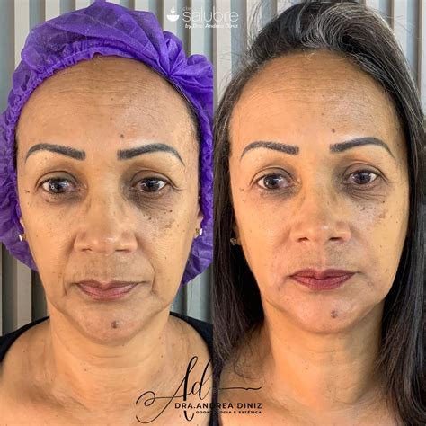 Clínica Salubre Odontologia E Estética Avançada Facebook