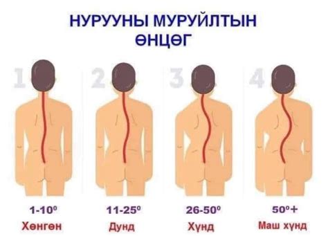 Маралгоо Уламжлалт Эмчилгээ Аарцаг Нурууны Бариа Заслын Төв Added A New Маралгоо