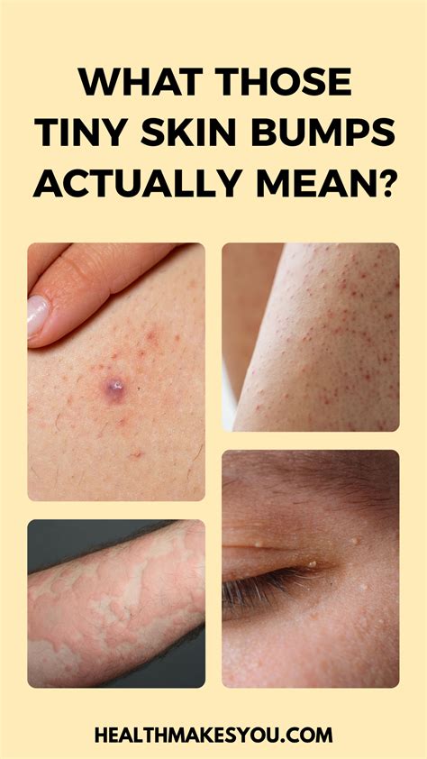 What Those Tiny Skin Bumps Actually Mean And How To Treat Them In 2025