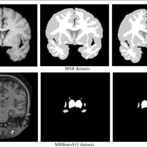 Sample Segmentation Result Left Target Image Middle Target Label Download Scientific