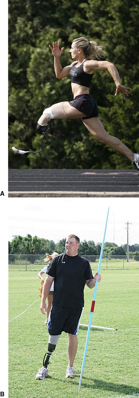 Athletic Options For Persons With Amputation Musculoskeletal Key